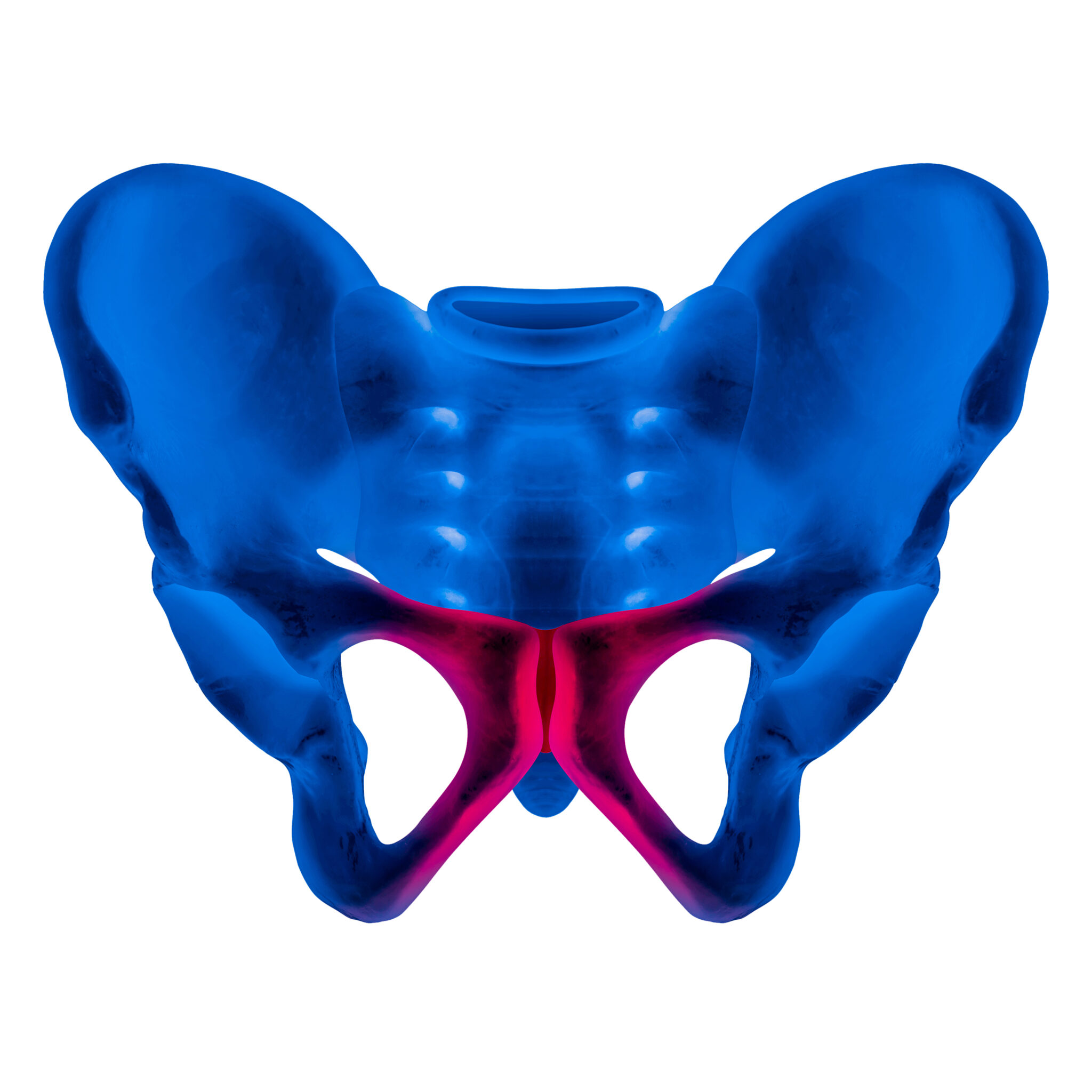 Pubalgia – Cirurgia de Quadril